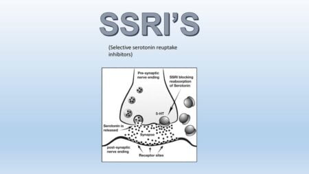 Understanding the Classification of Wellbutrin: SSRI, SNRI, or NDRI ...
