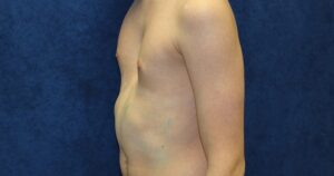 15 Natural Remedies and Stretches to Ease Flared Rib Pain - Theresa Reviews